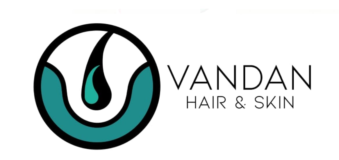 Alopecia por Vandan Hair & Skin - Plan B